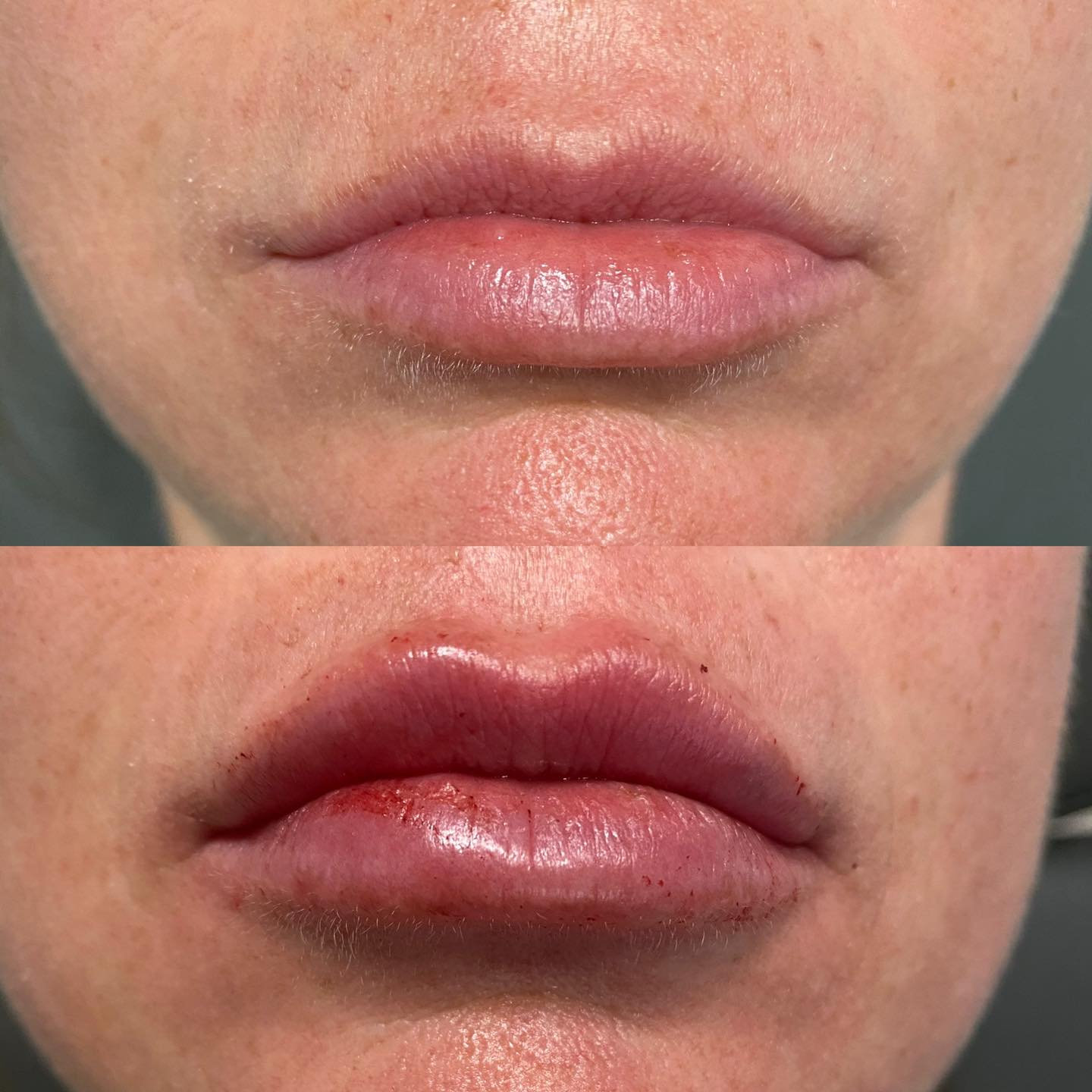 Luxurious Facial & Lip Treatments - Jamie Goode Studios, LLC